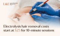 Electrolysis Hair Removal Cost in 2026: Full Price Guide