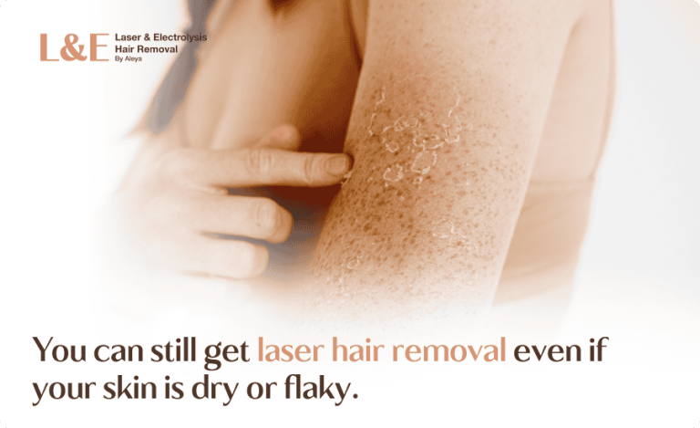 5 Reasons You Get Laser Burns & How To Prevent Them