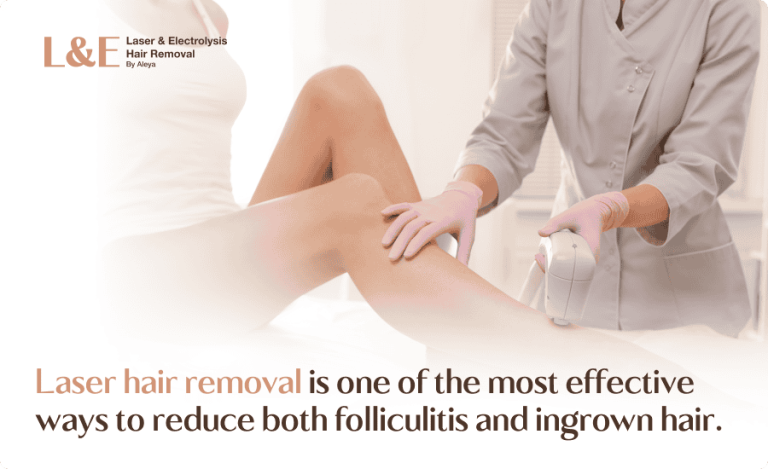 Transgender Laser Hair Removal: What To Expect & MTF Timeline